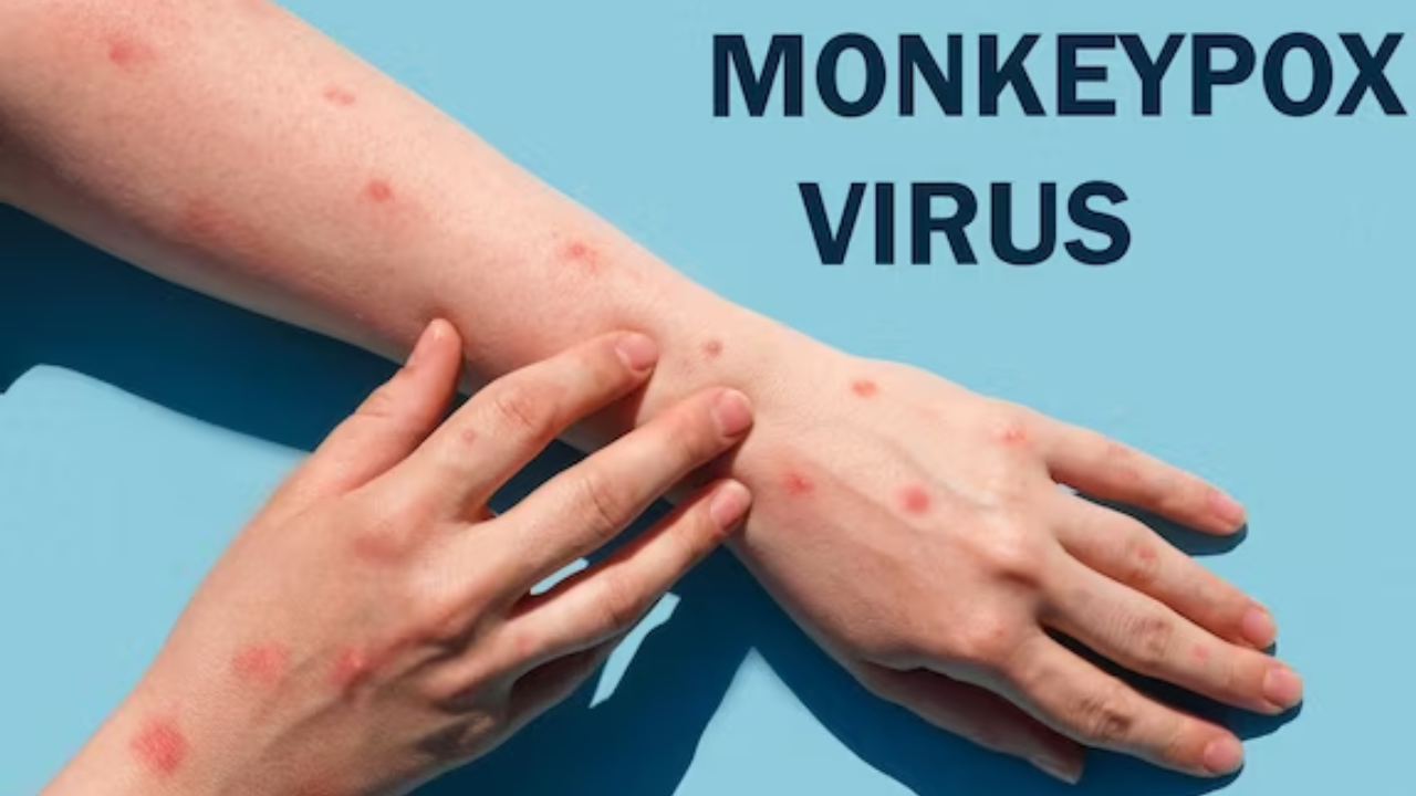 Mpox Outbreak: With Monkeypox Cases On The Rise, WHO Raises Alert ...