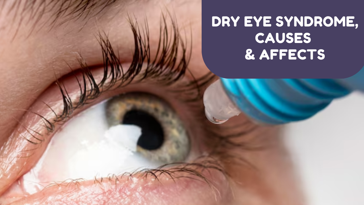 What Is Dry Eye Syndrome And What Are The Key Causes That Affect It ...
