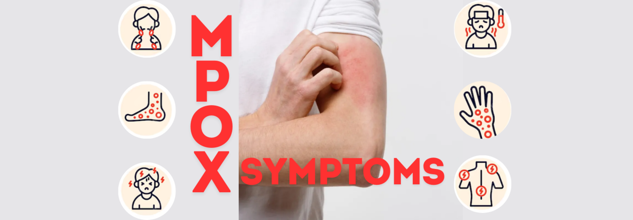 Worried About MPOX? Find Out How Quickly Symptoms Develop And What To ...