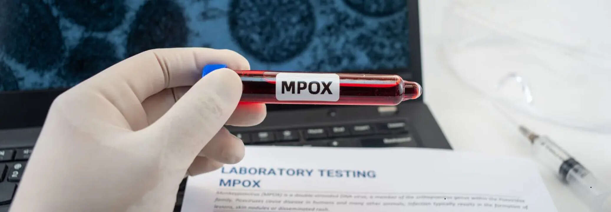 Mpox Case Suspected In India; Samples Being Tested | Health and Me