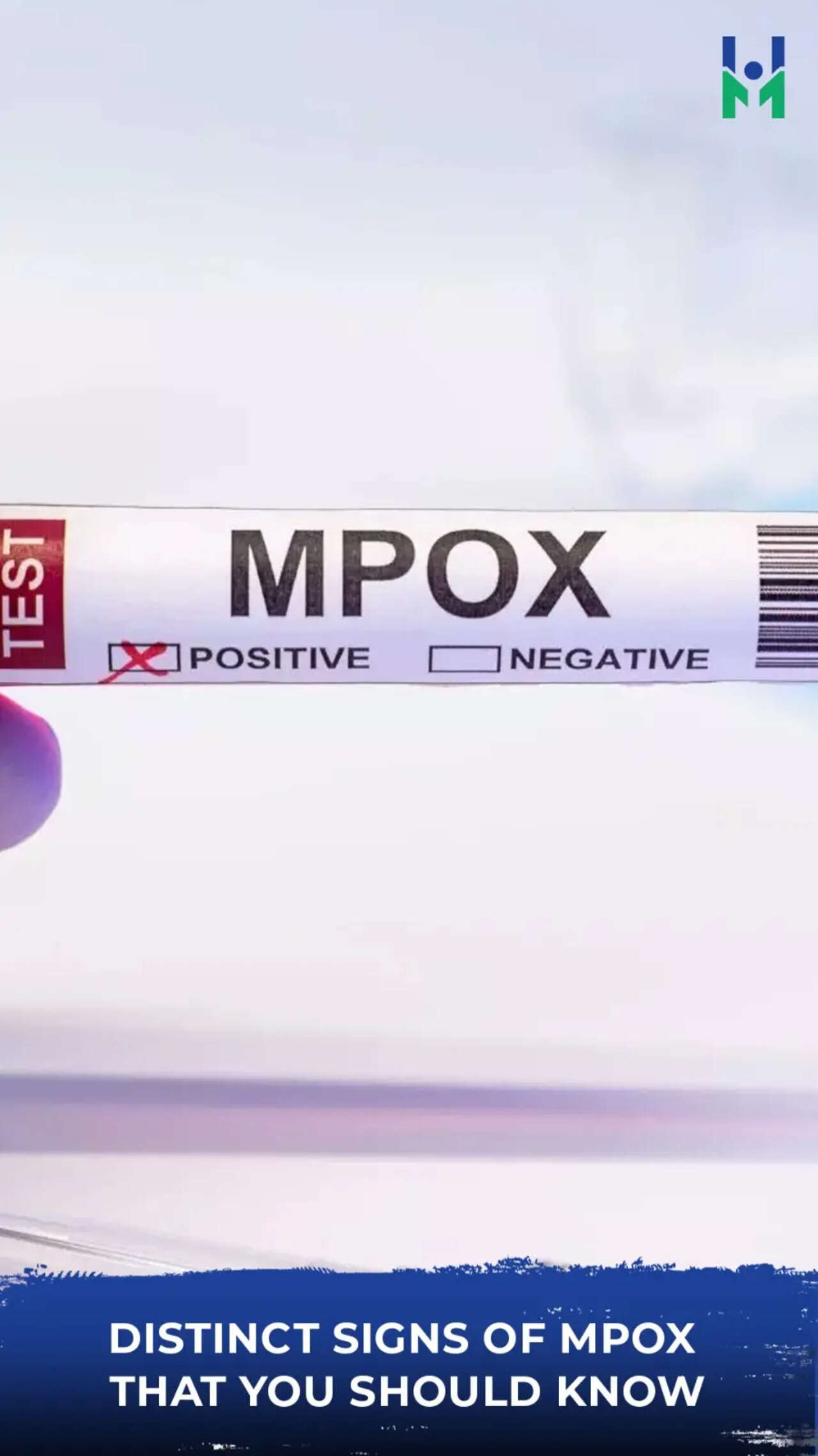 Distinct signs of Mpox that you should know