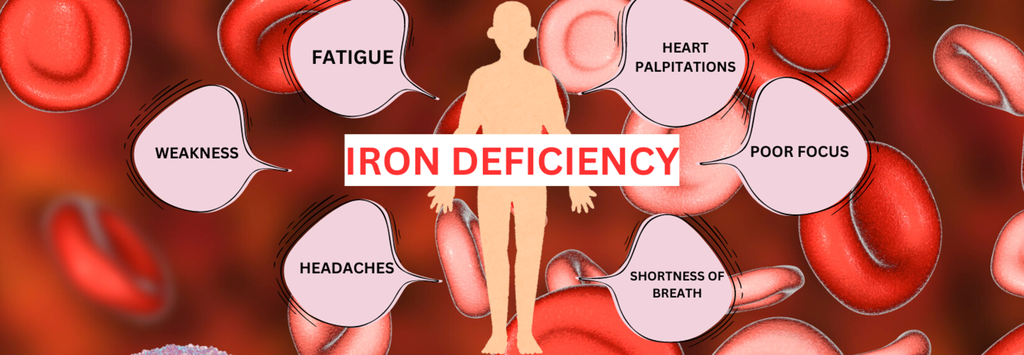 Symptoms Of Iron Deficiency: Cold Hands And Brittle Nails? Could Be ...