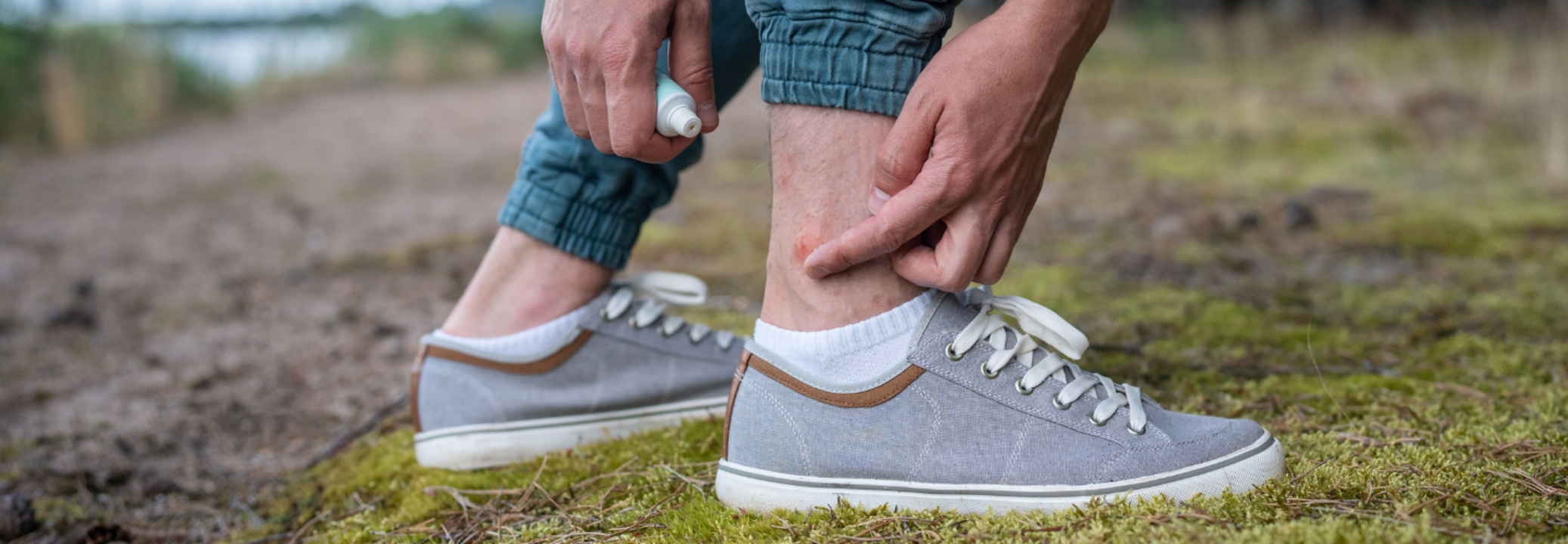 Why Do You Feel Itchy After A Run | Health and Me