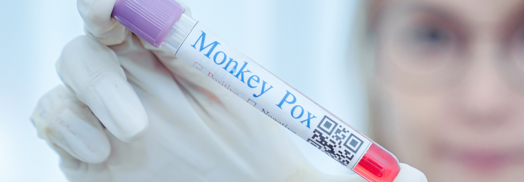 WHO Approves World's First Mpox Diagnostic Test | Health and Me