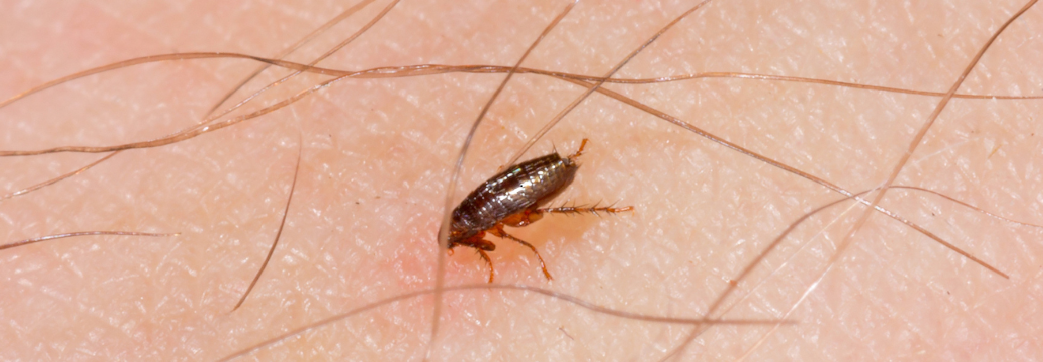 Kerala Man Reports Case Of Murine Typhus, Here Is What You Need To Know ...