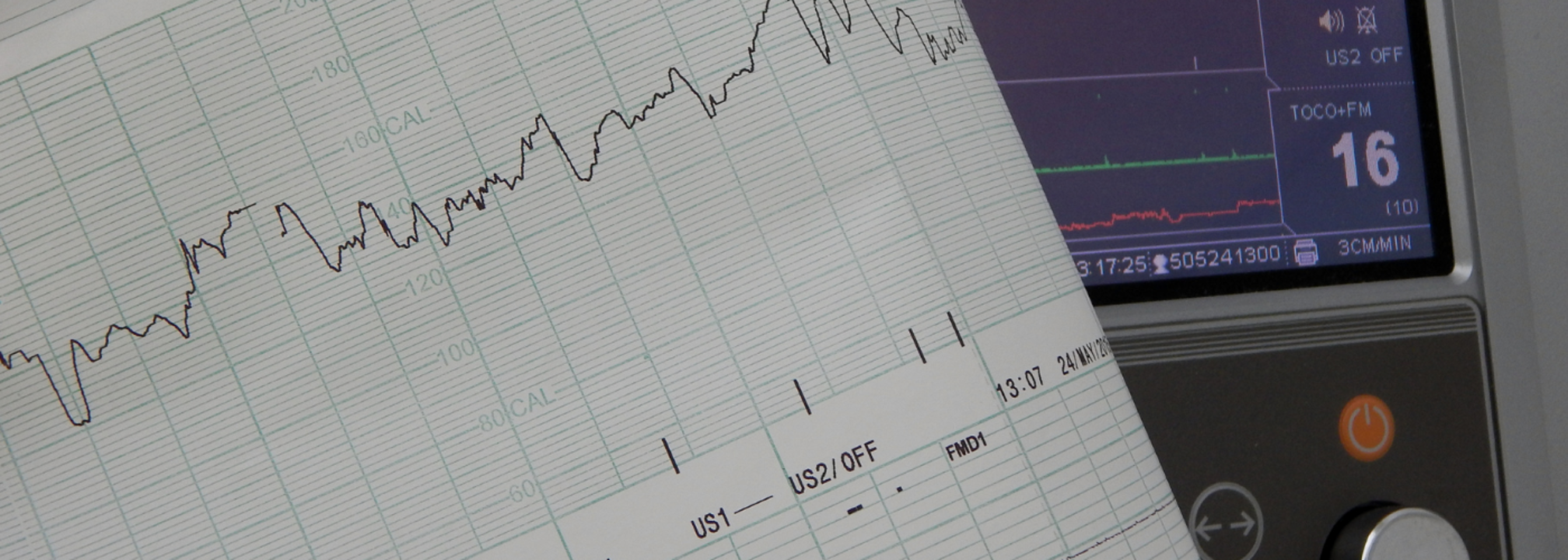 What's Your Pulse Rate Should Be At Every Age | Health and Me