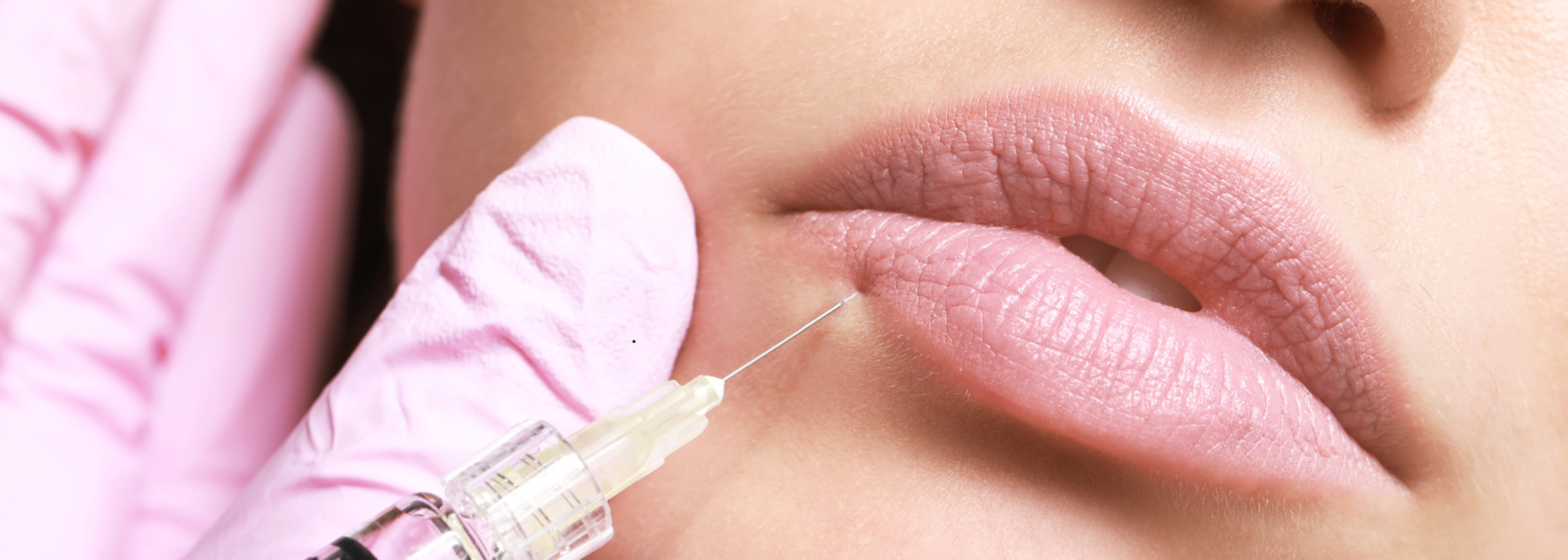 Expert Explains: How Long Do Lip Fillers Last? | Health and Me