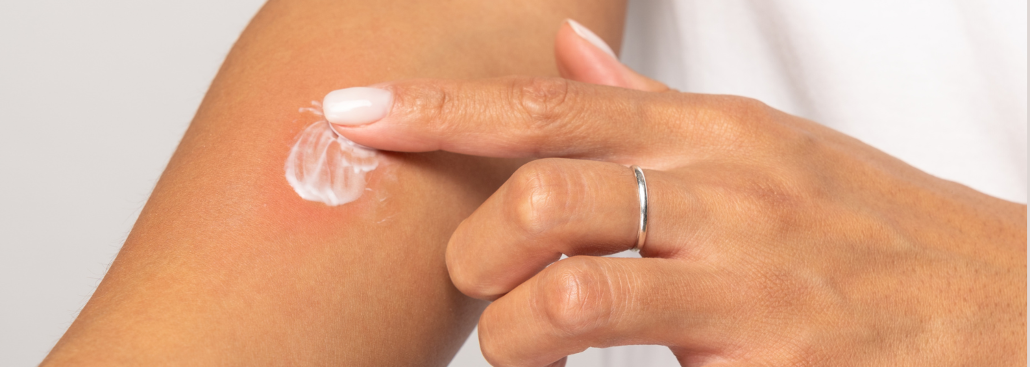 6 Treatments To Get Rid Of Ringworms | Health and Me
