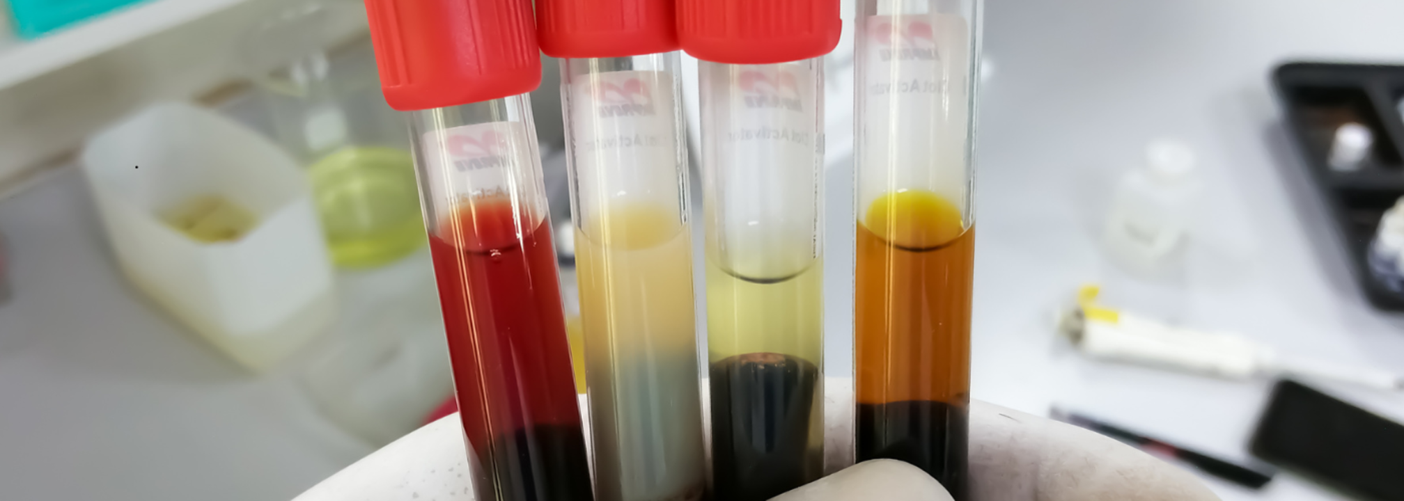 A Blood Type Like No Other: All You Need To Know About The Rare 'Golden ...