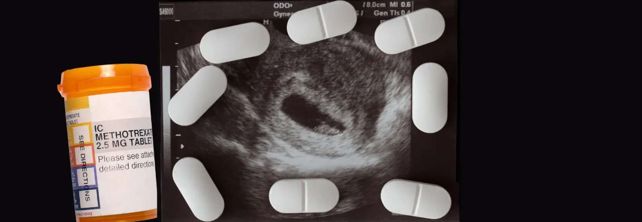 Researchers Discover Mifepristone Alternative Amid Legal Battle On ...
