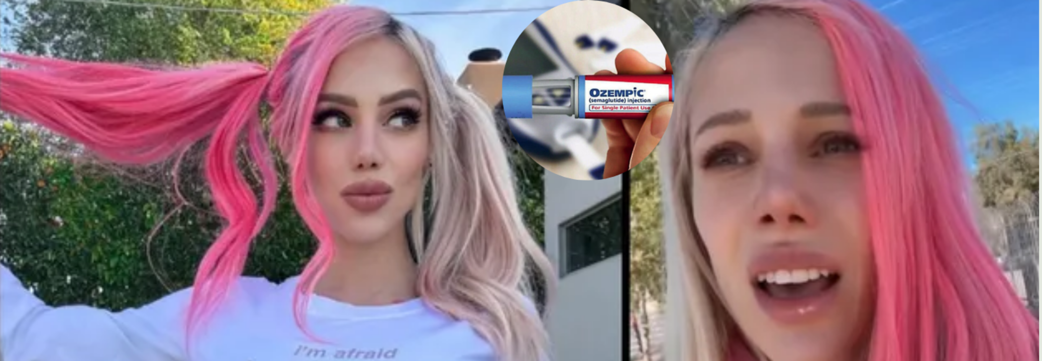 'Ozempic Use Left Me With Significant Bone Loss', Singer Avery Shares ...