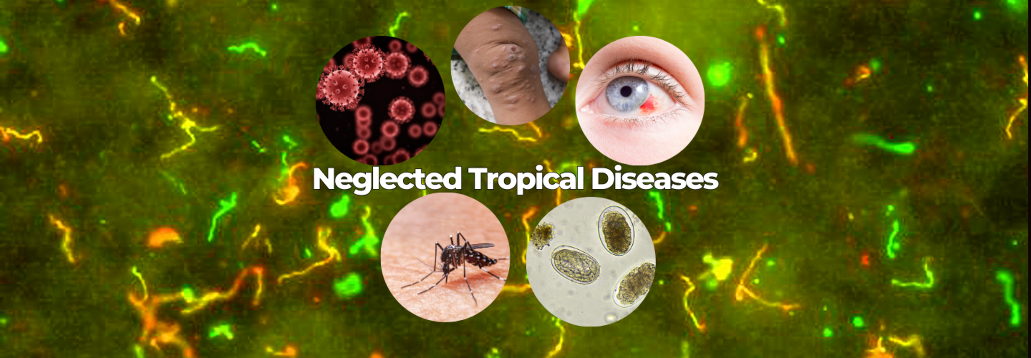 Over 1 Billion People Worldwide Suffer From Neglected Tropical Diseases ...