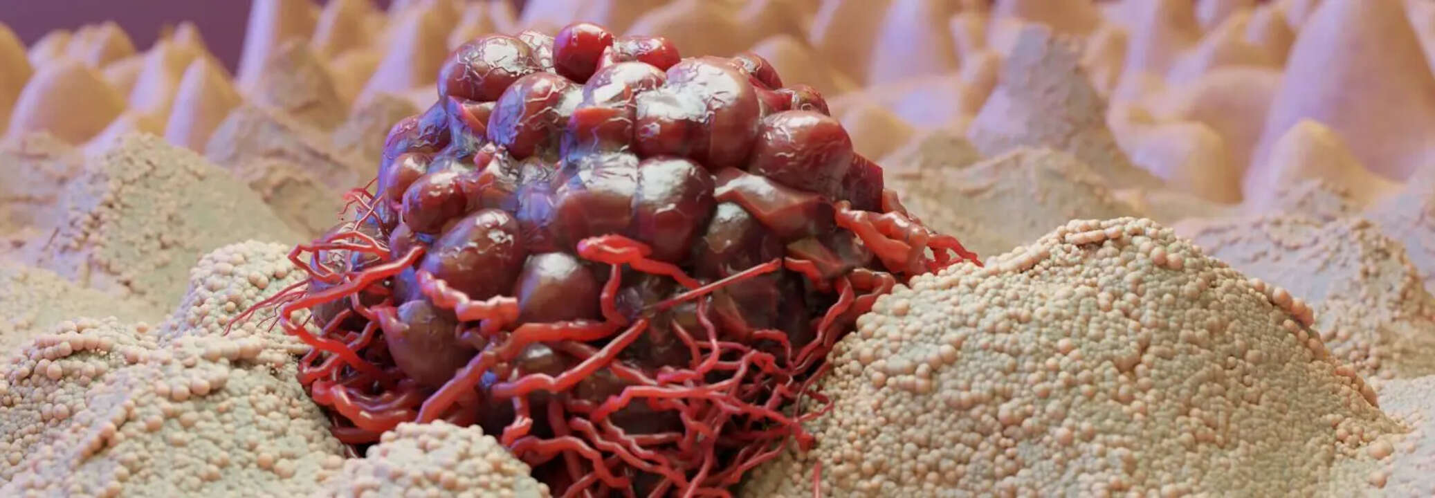 World Cancer Day: The 5 Deadliest Cancers & Key Risk Factors You Should ...