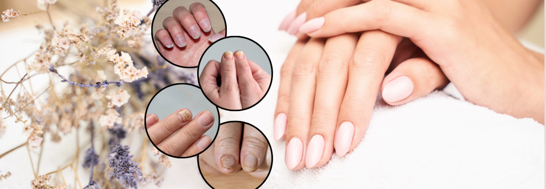 Don’t File This Away! 15 Nail Changes That Could Signal To Serious ...