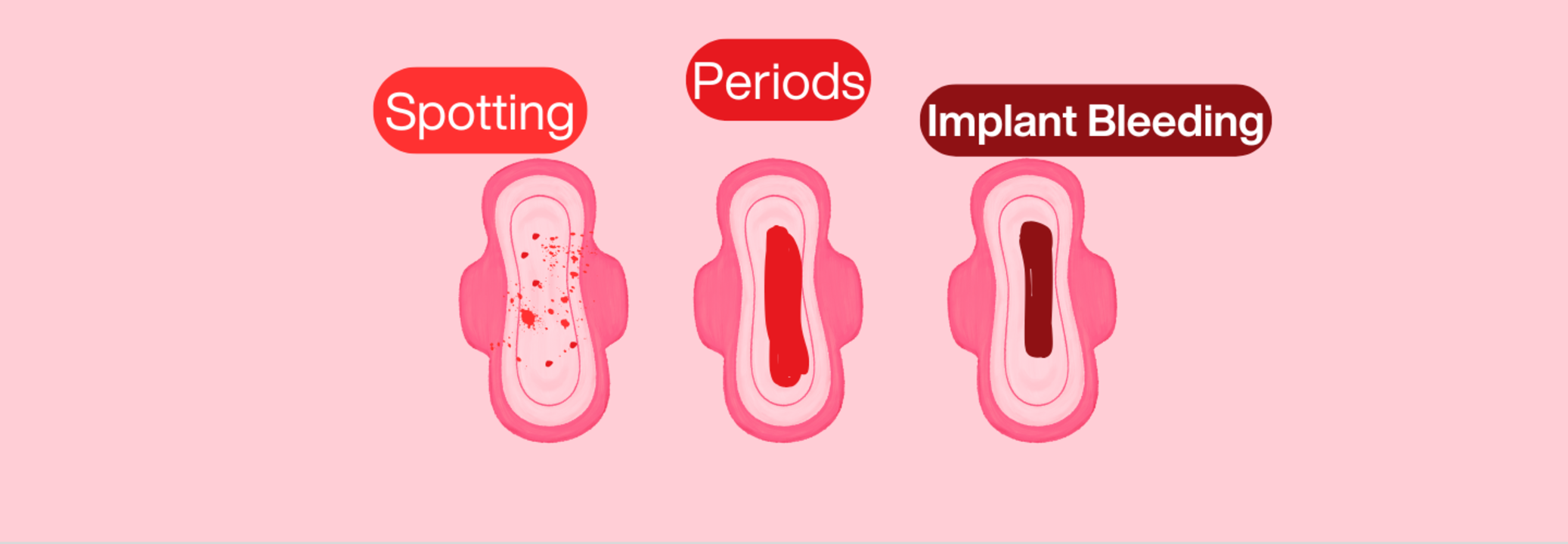 Spotting vs Period vs Bleeding: How To Identify | Health and Me