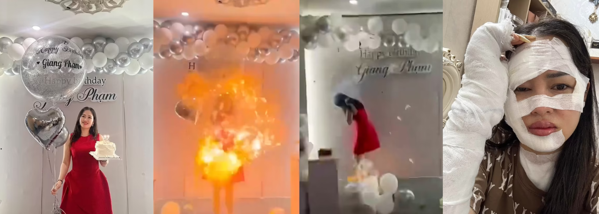 Birthday Celebrations Gone Wrong When A Hydrogen Balloon Exploded ...