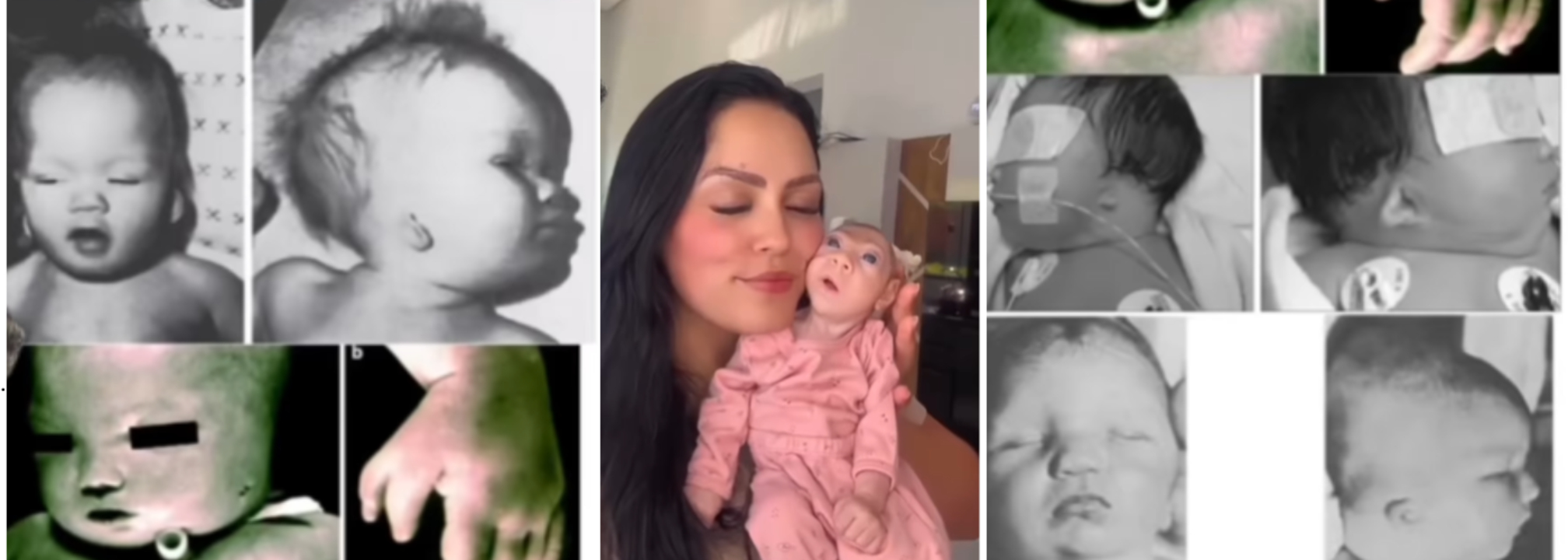 What Happens If You Get Pregnant On Accutane? | Health and Me