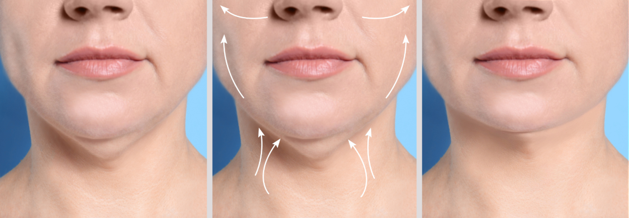 You Don't Need Fancy Tools To Reduce Double Chin - Simple Exercise To ...