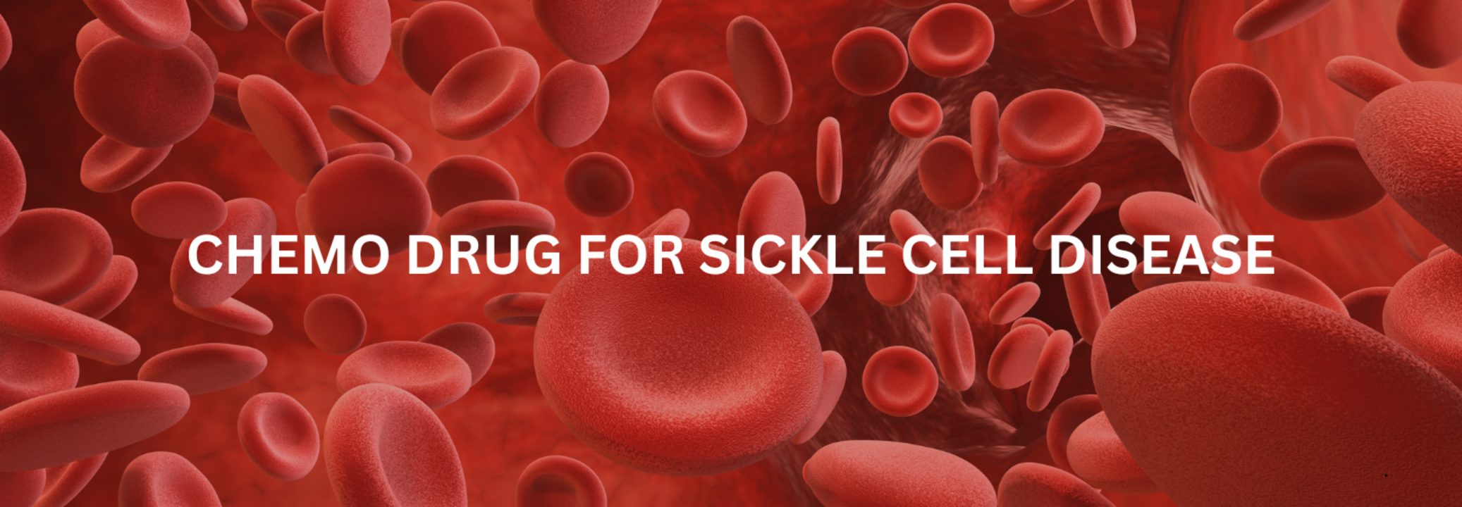 Chemo Drug Could Be Effective For Kids With Sickle Cell Disease ...