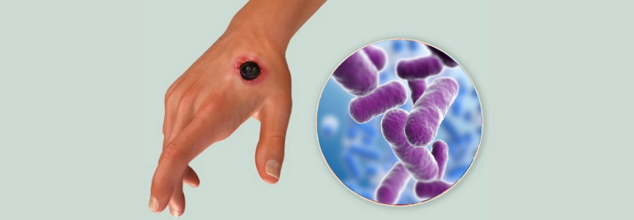 Thailand Confirms First Anthrax Death In 30 Years Raises Alarm Over ...