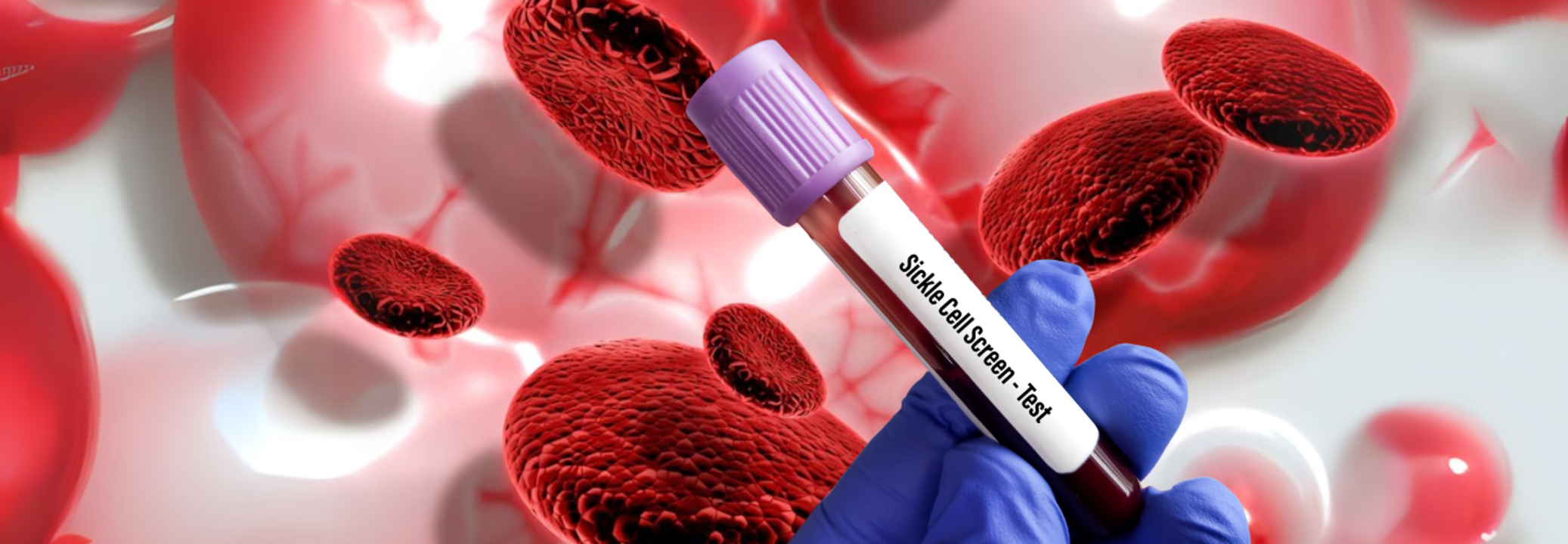 CDC Budget Cuts May Hit Women With Chronic Diseases Like Sickle Cell ...