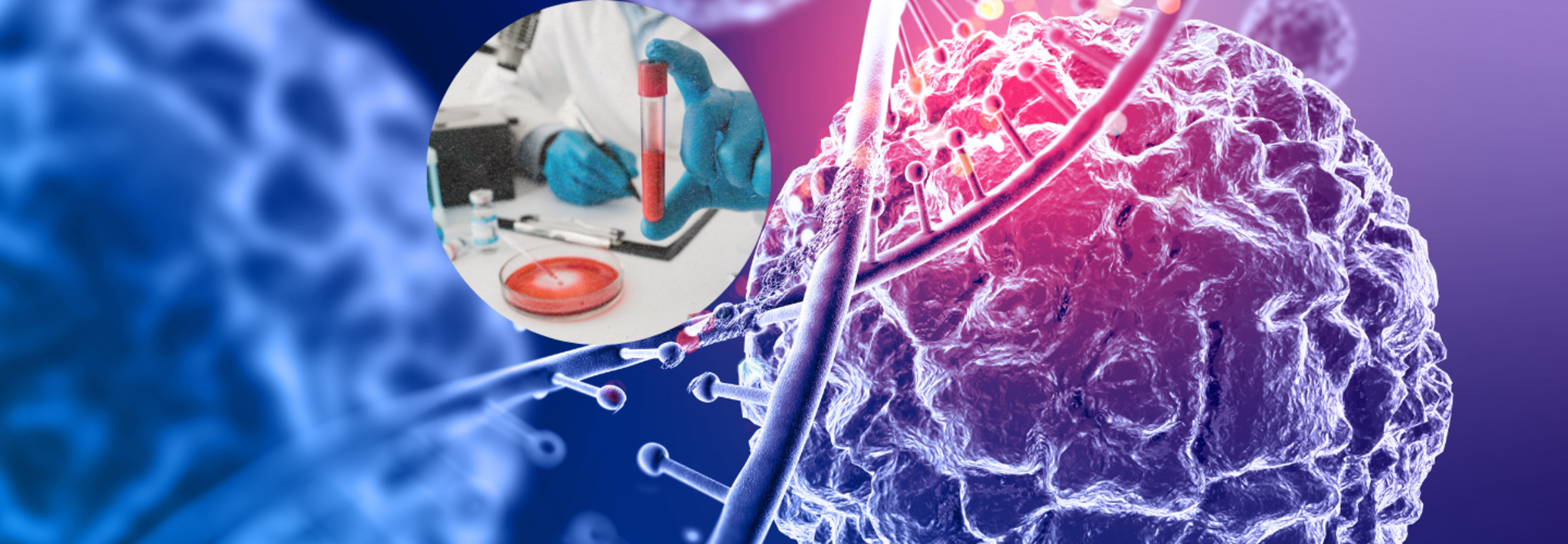 Scientists Detect Early Signs of Cancer In Patient Blood Years Before ...