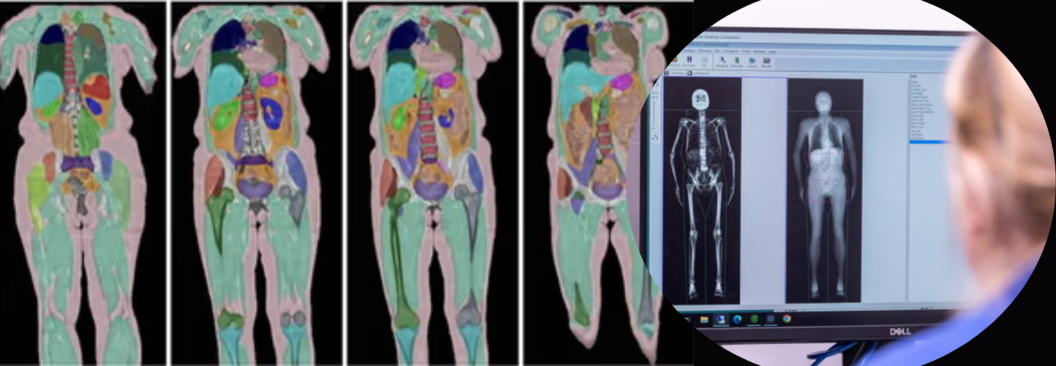 UK Scientists Scan Over 100,000 People, What The Human Imaging Study ...