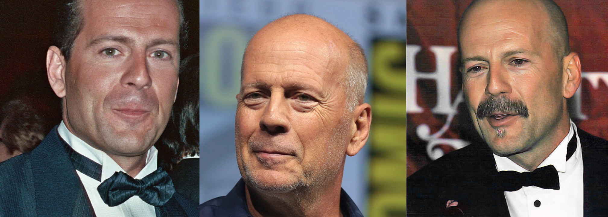 Bruce Willis' FTD: The Dementia That Strikes Before 60: What You Need ...