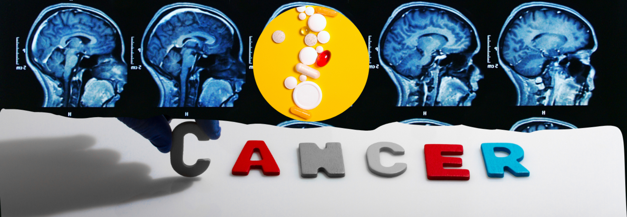 Could These Common Cancer Drugs Could Be The Key To Reversing And ...