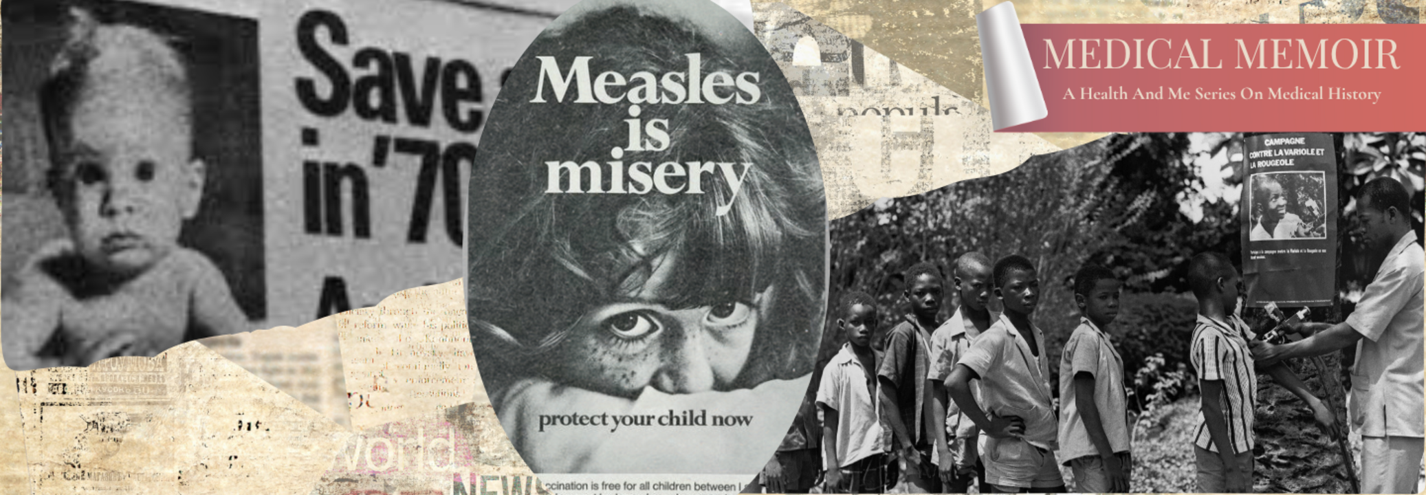 Medical Memoir: Measles- The Unfinished Fight Against One Of The World ...