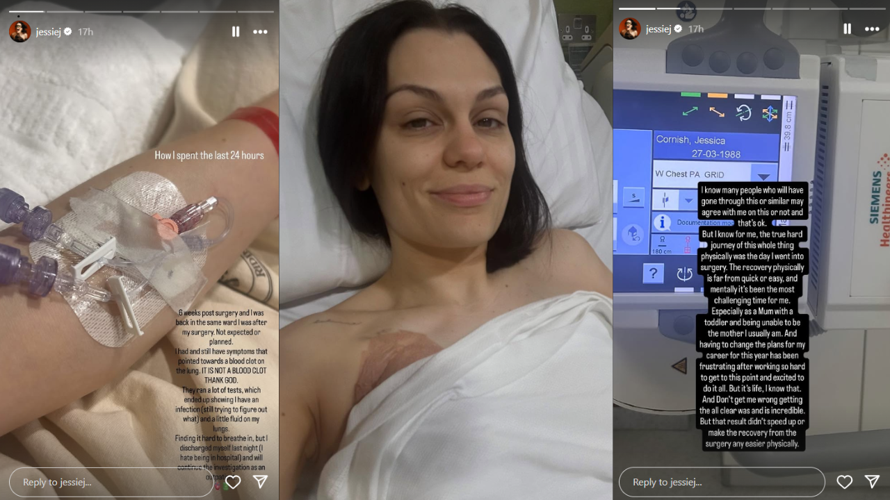 Jessie J Health Update: Hospitalized Weeks After Cancer Surgery Due To Lung Infection | Health ...