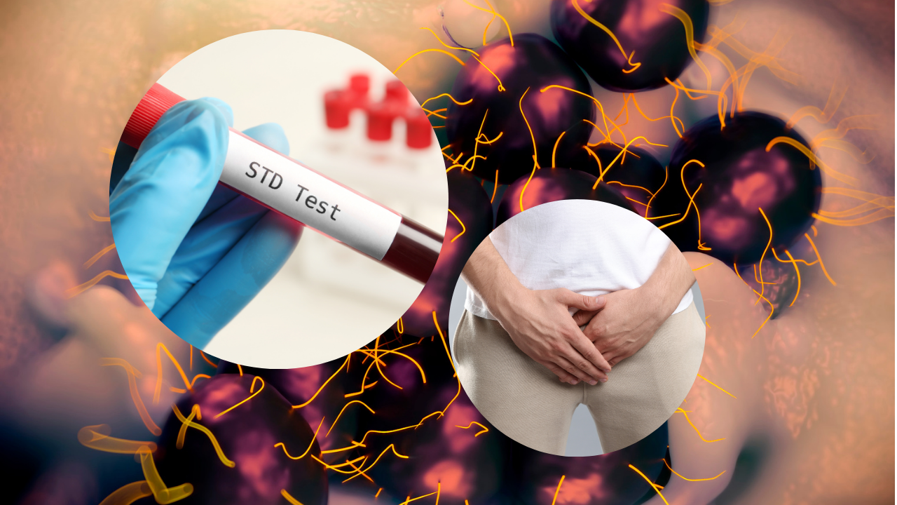 US Faces Nationwide STD Epidemic As Cases Surge Past 2.3 Million ...