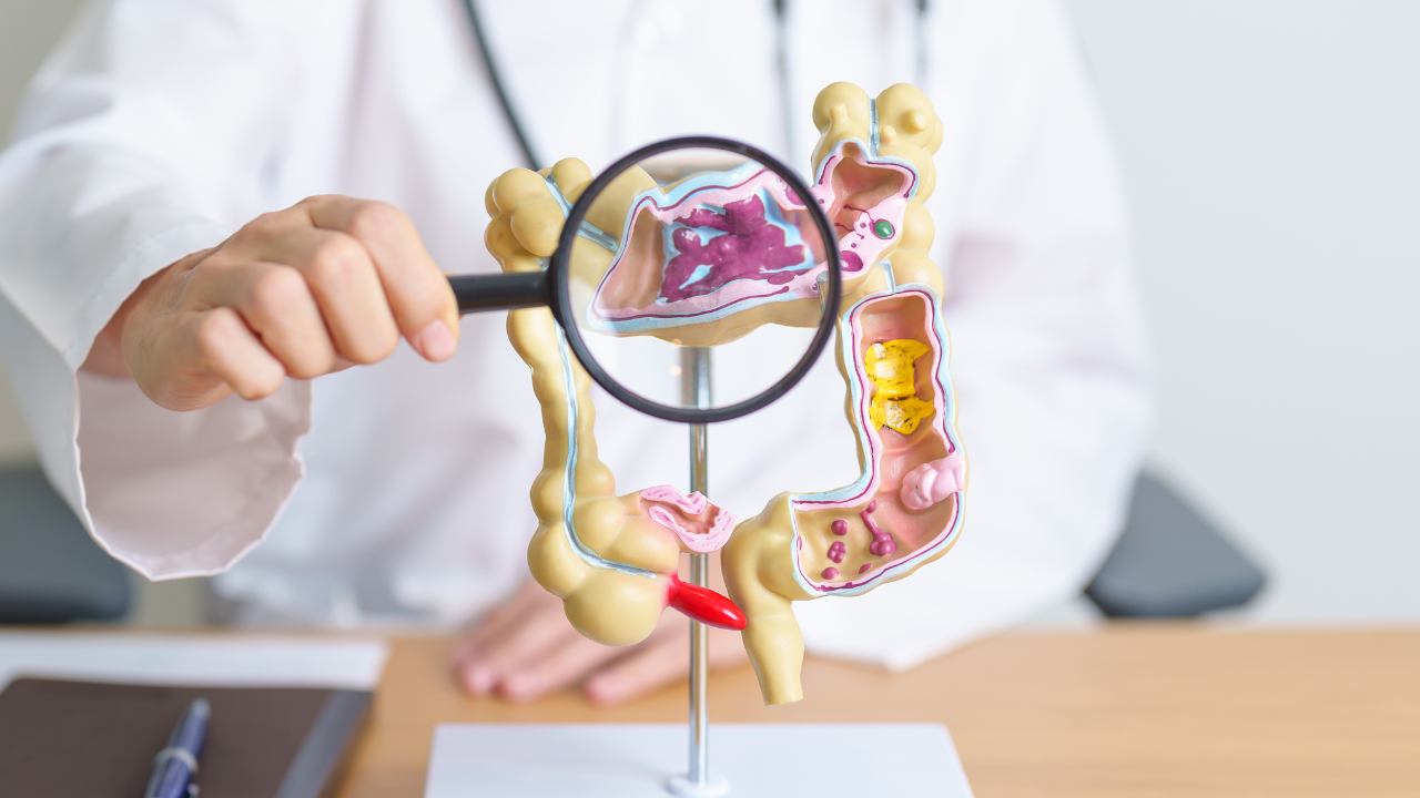 Colon Cancer Screenings Help Catch The Deadly Disease Earlier - Is ...