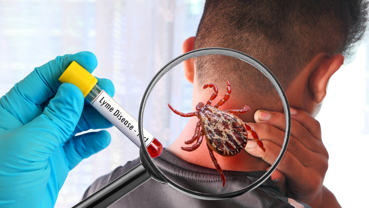 Unique Symptoms Of Lyme Disease In 2025 And How Long Infection Now Last ...