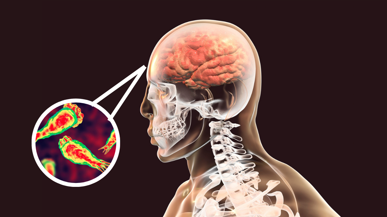 9-Year-Old Passes Away In Kerala Due To 'Brain Eating Amoeba' Infection ...