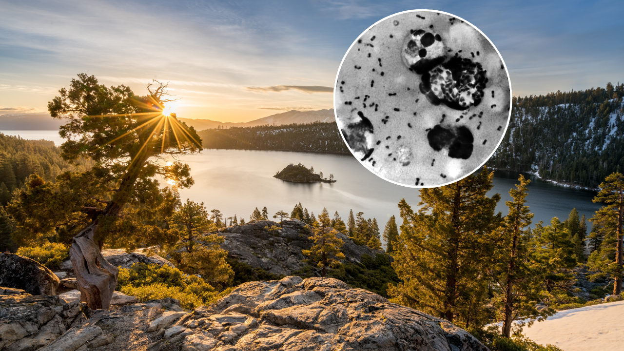 California Resident Plague Case 2025, Officials Trace Case Back To Lake ...