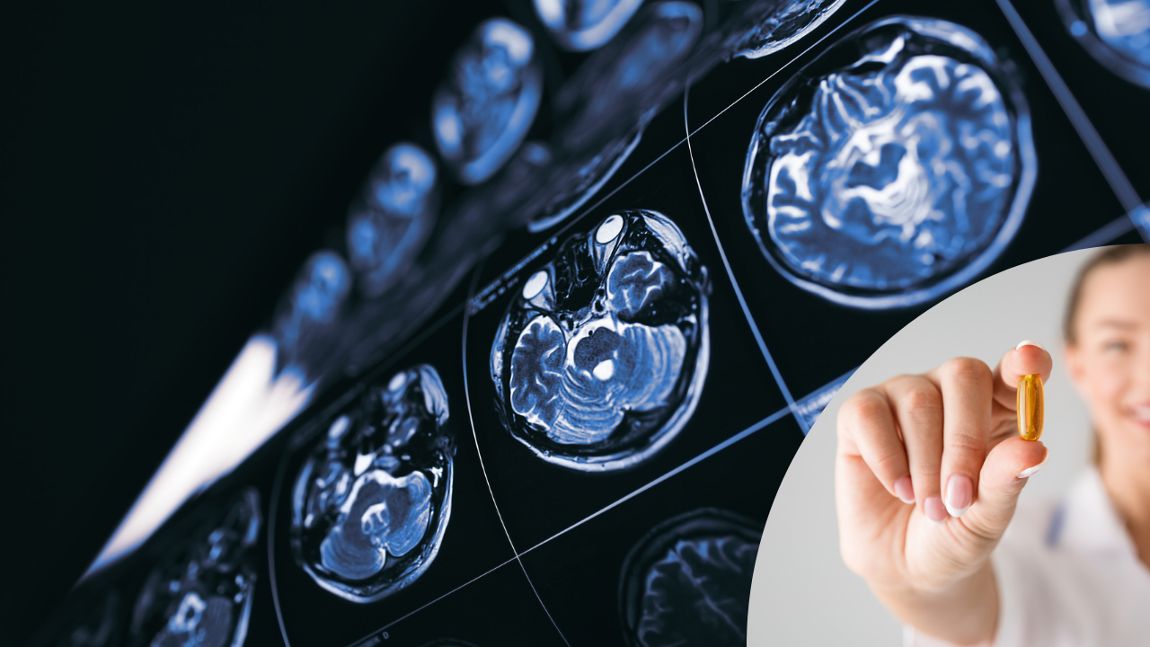 Could A Daily Pill Restore Brain Function After Stroke? Scientists Test ...