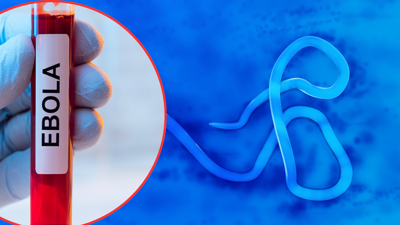 Congo Ebola Outbreak Caused By The Zaire Strain So Far Has 28 Deaths ...