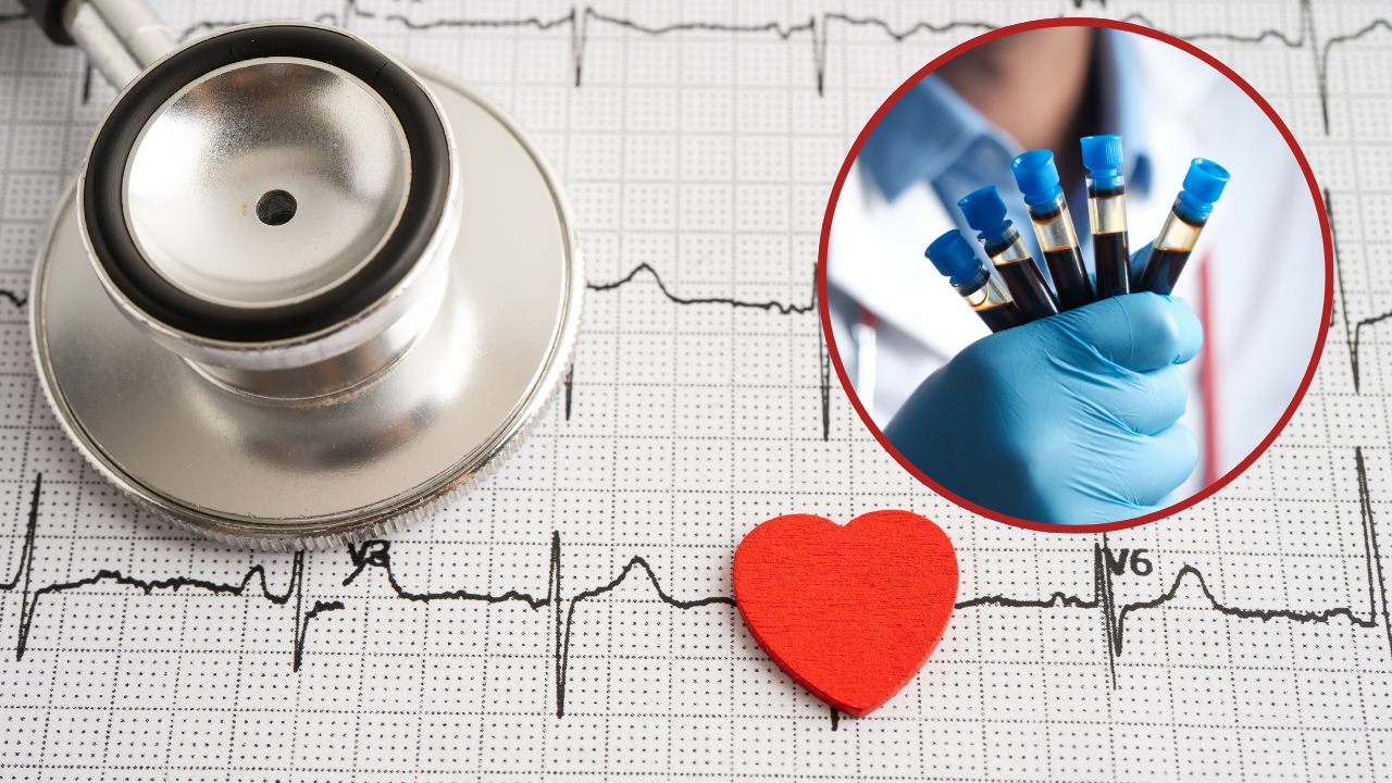 Heart Transplant Doctor Reveals Crucial Blood Test That Can Predict ...