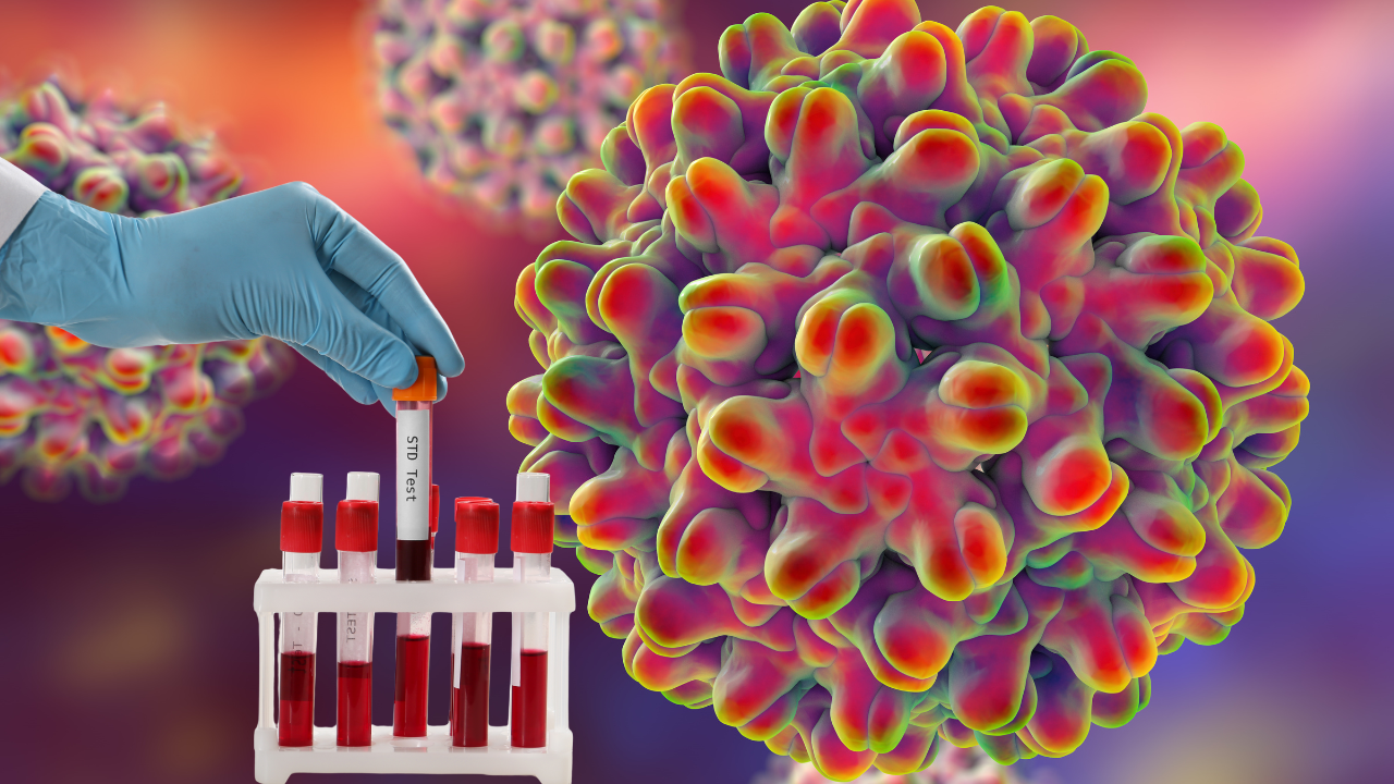 STD Cases Have Declined In US Adults, But Syphilis Continue To Rise In ...