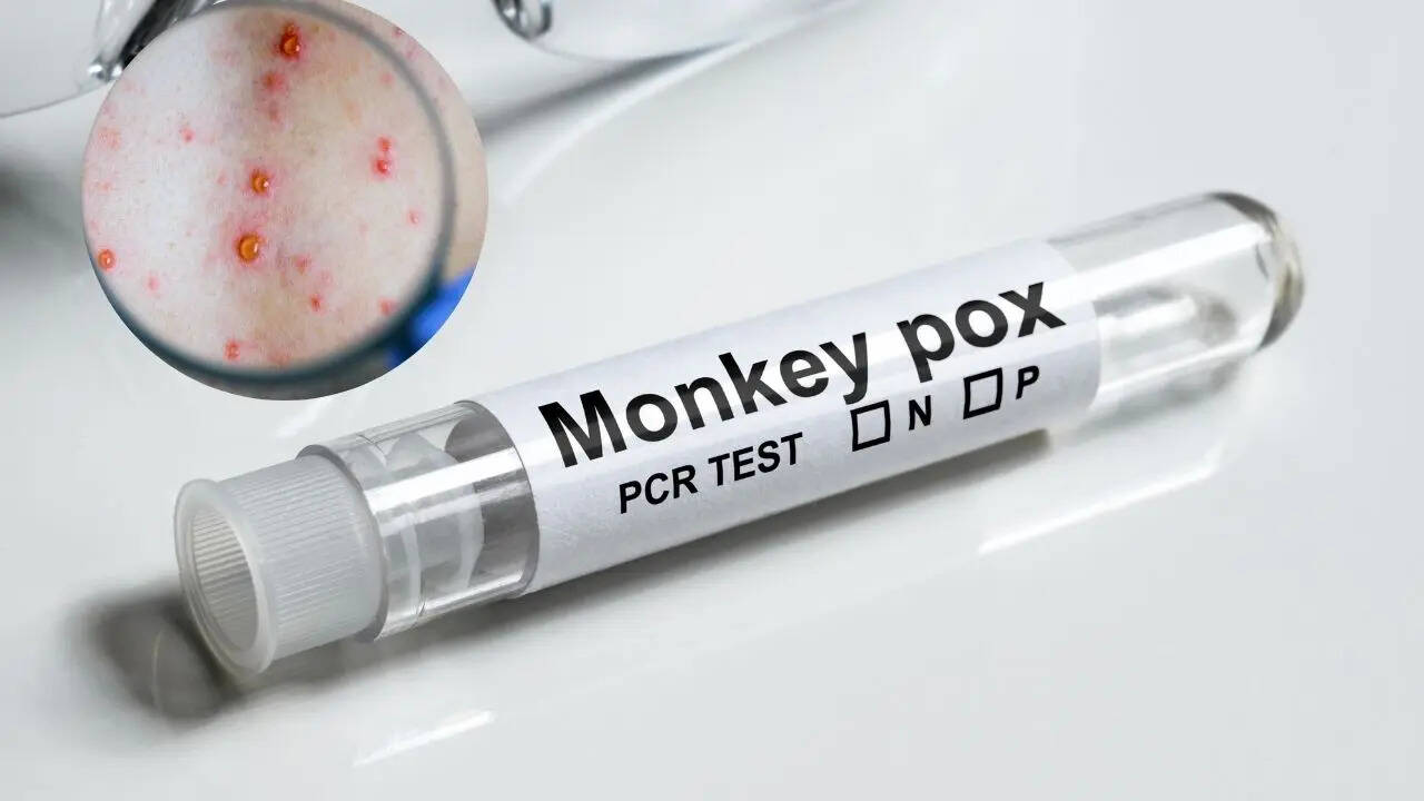 WHO Warns Of Rising Mpox Cases As New ‘Clade Ib’ Strain Spreads ...