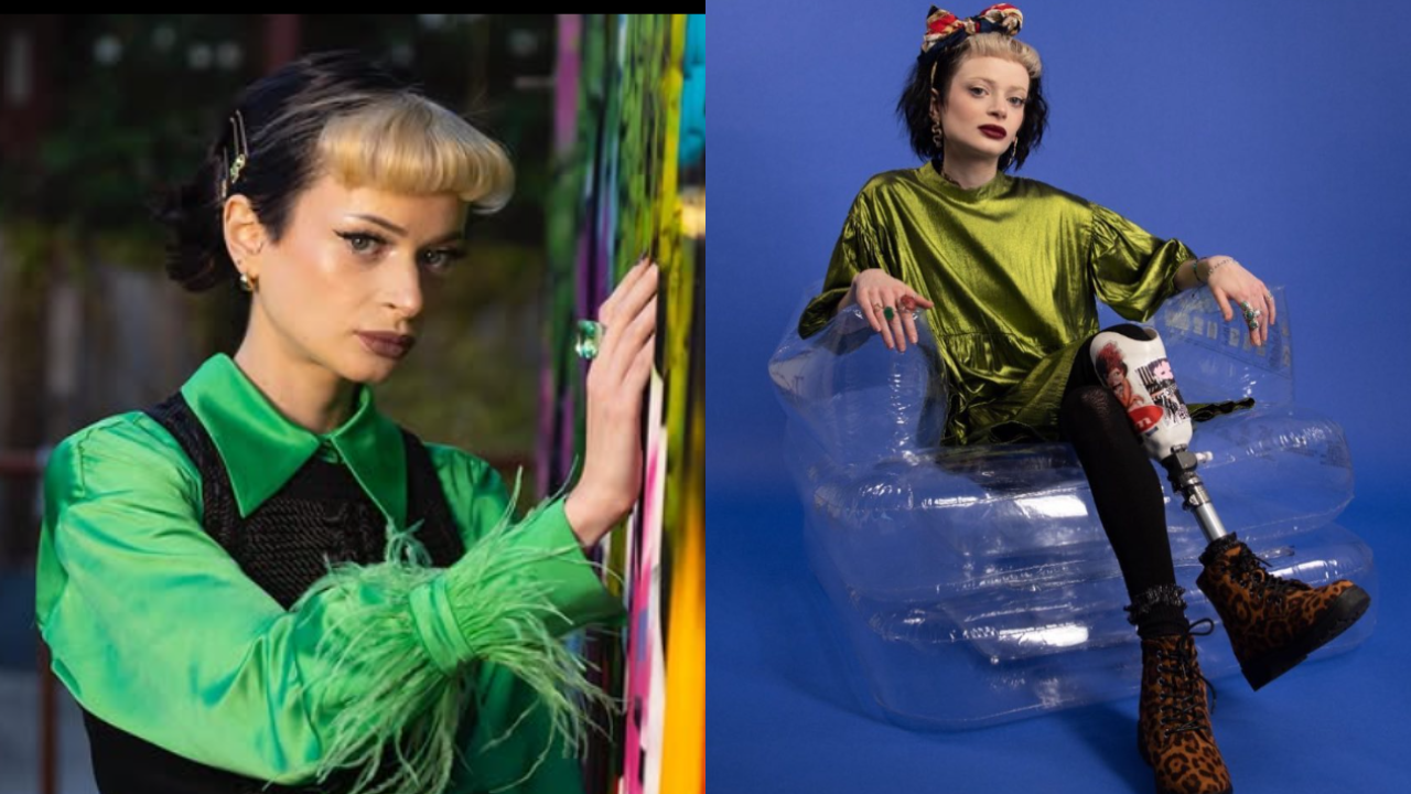 Ruth Codd Reveals She Is Recovering From Second Leg Amputation | Health ...