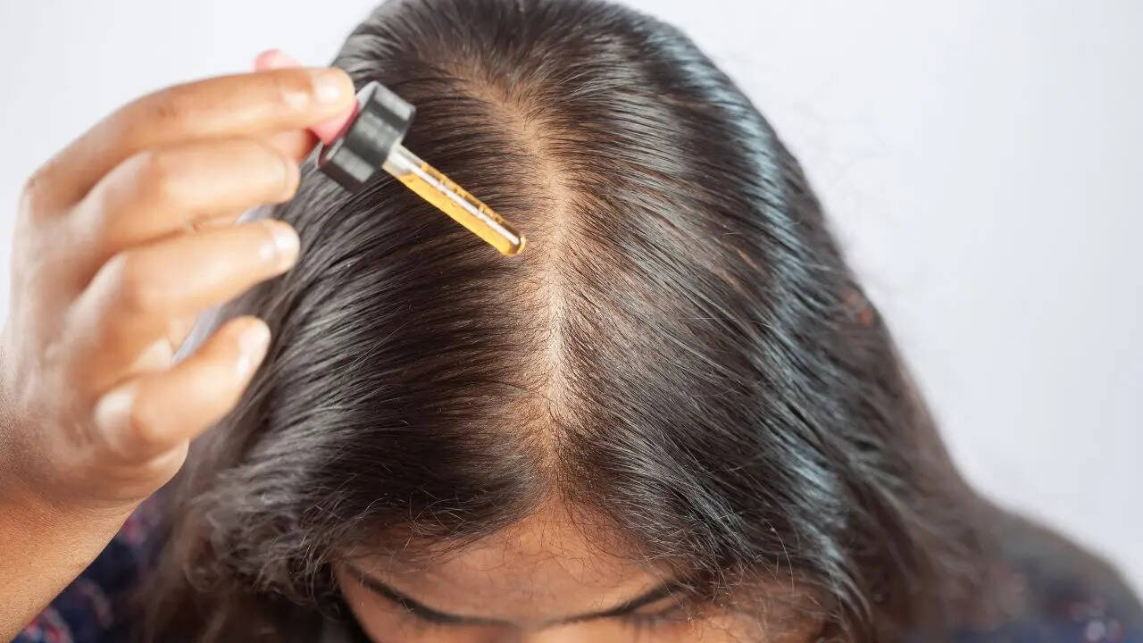 Minoxidil Use By Mothers Linked To Potential Health Risks In Infants ...