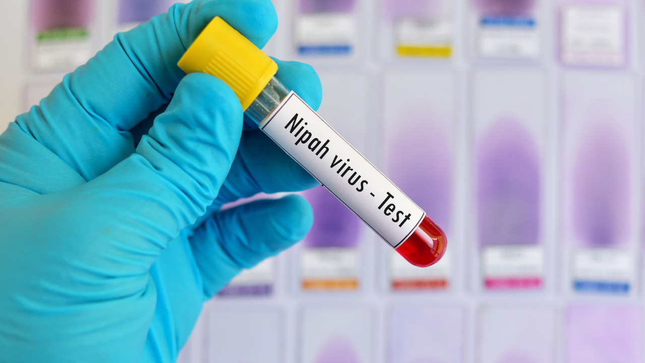Nipah Virus Case Detected In Two Nurses From West Bengal | Health and Me