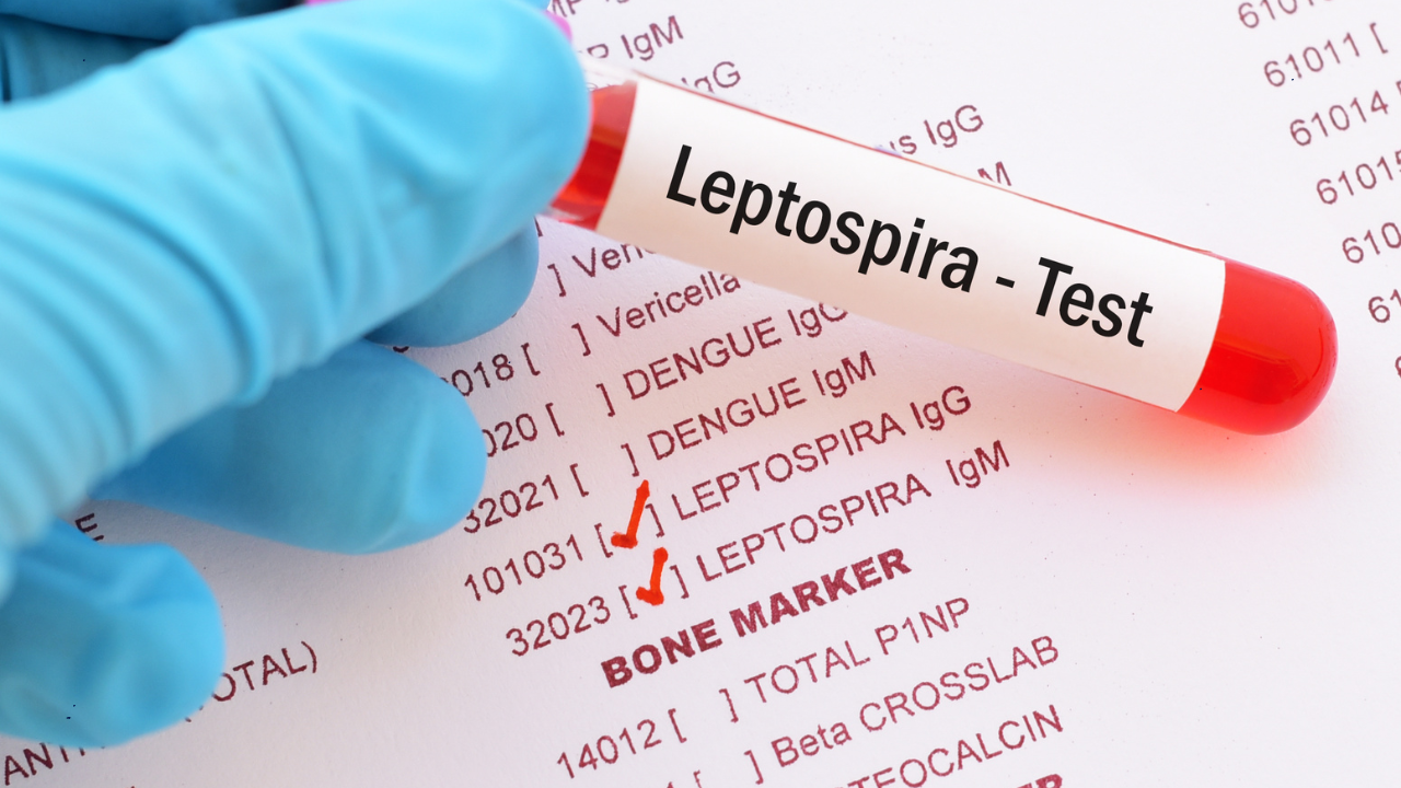 Punjab Leptospirosis Outbreak: 36 Test Positive, 19 Children ...