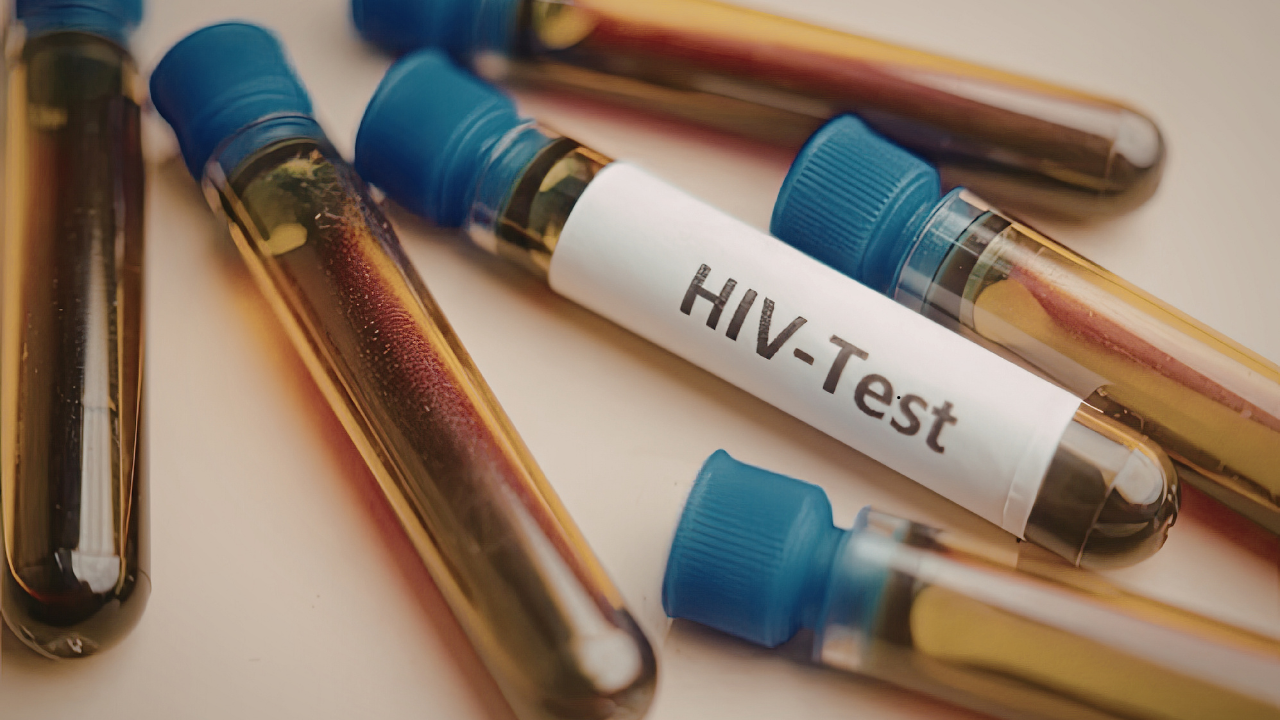 Years After PrEP Rollout, The HIV Prevention Drug Still Remains A ...