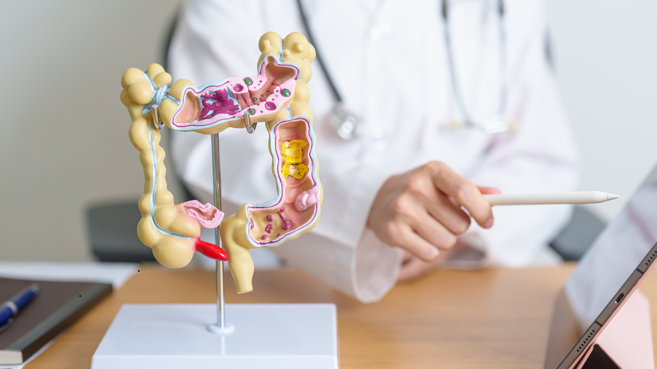 Colon Cancer Is The Leading Cause Of Death In US For People Under 50 ...