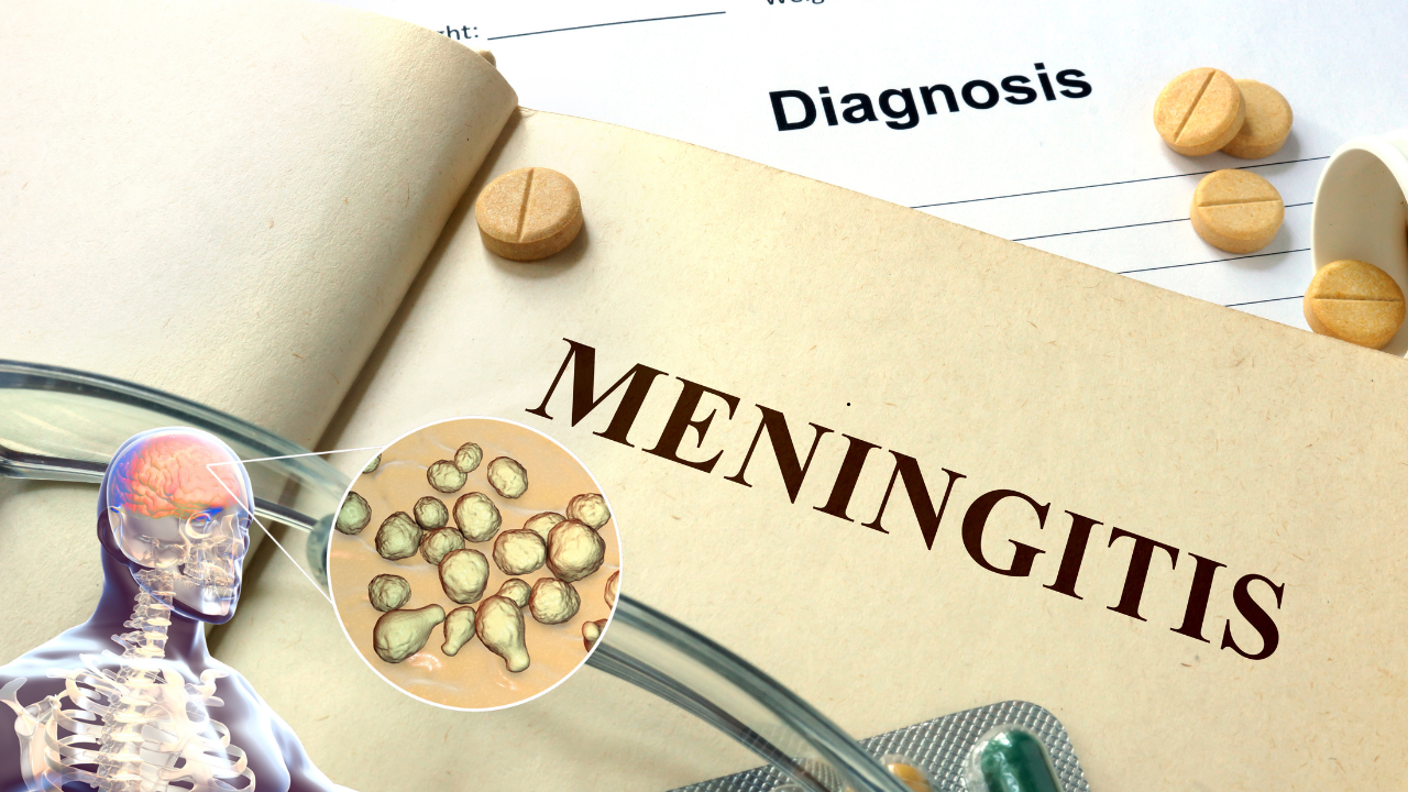 Kent Uni Meningitis Outbreak Caused By Less-Targeted Strain B | Health ...