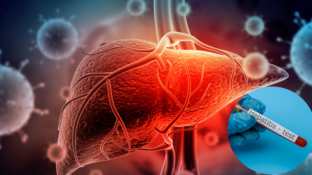 Hepatitis Infections Claims 1.3 Million Lives Worldwide, India Among ...