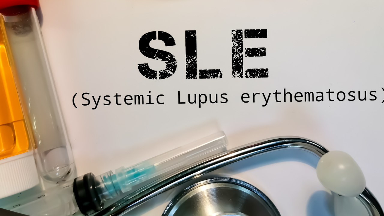 Understanding Lupus: When The Immune System Turns Against The Body ...